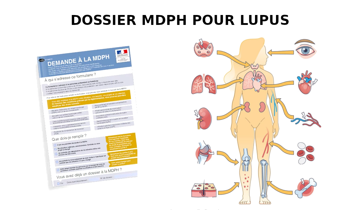 Dossier MDPH Lupus - Reconnaissance du handicap